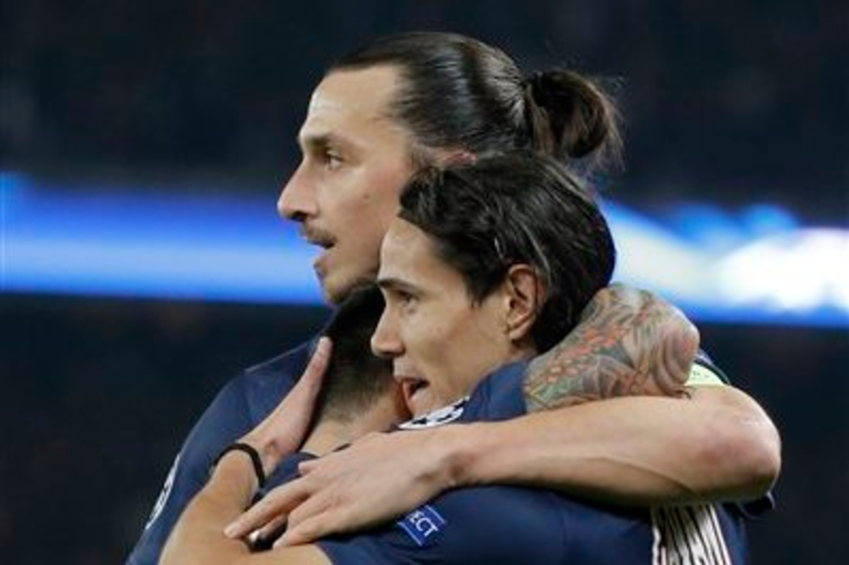 Zlatan Ibrahimovic Nose Job
