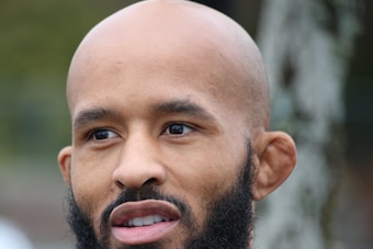 how to make cauliflower ear worse