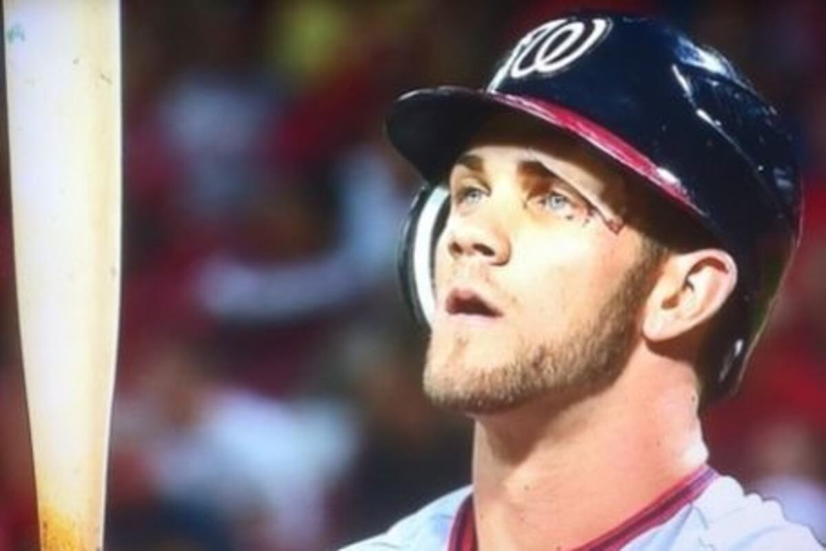 Bryce Harper Injury: Updates on Nationals' RF After Receiving Stitches ...