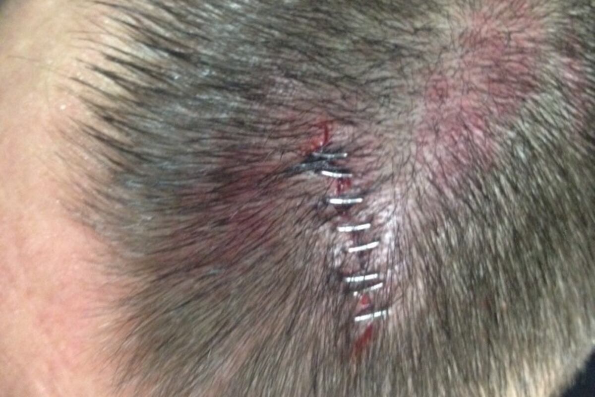 WWE News: CM Punk Fires Back on Blading Allegations | News, Scores ...