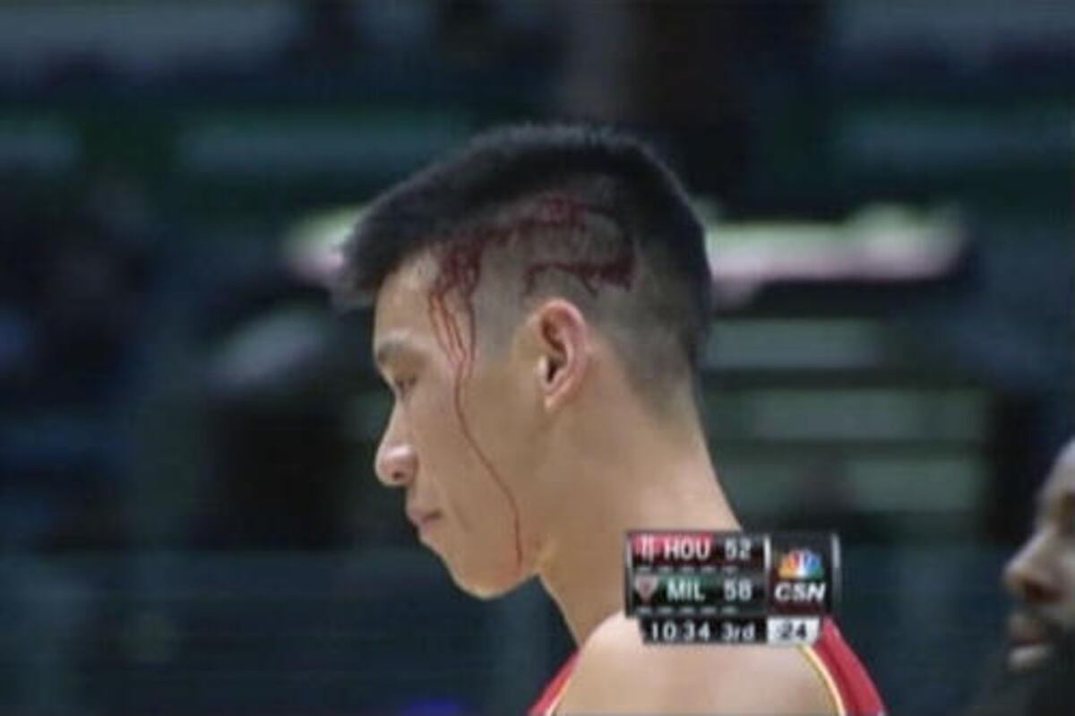 Jeremy Lin Injury: Updates on Rockets PG's Head | News, Scores ...