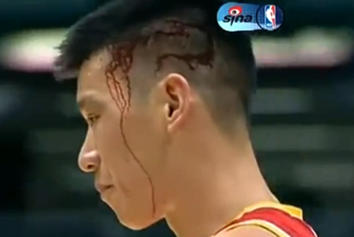 Jeremy Lin Goes to Locker Room Bloodied After Head-on Collision | News ...