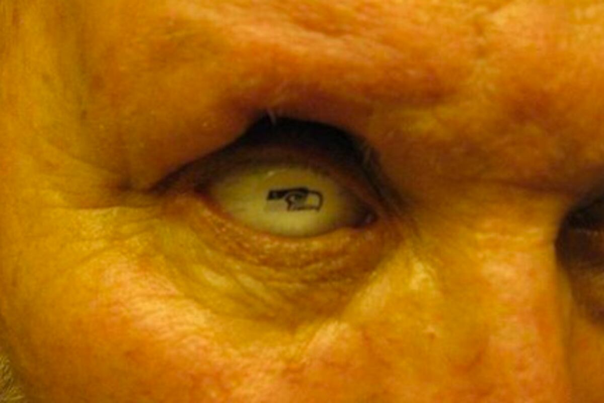 Seattle Fan Receives Seahawks-Themed Prosthetic Eye as Anniversary ...