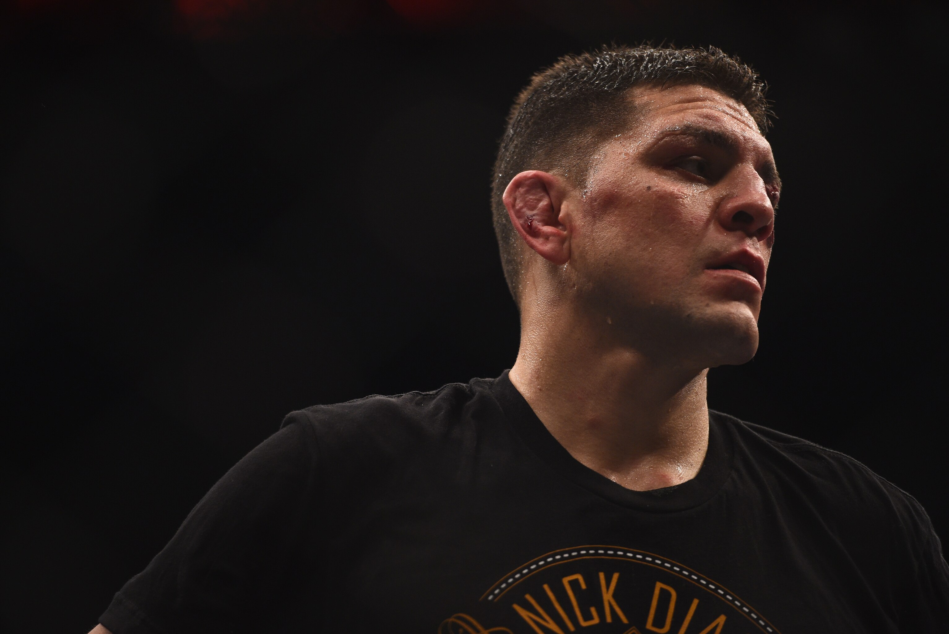 Nick Diaz Reportedly Jumped by 4 Men, Involved in Las Vegas Nightclub ...